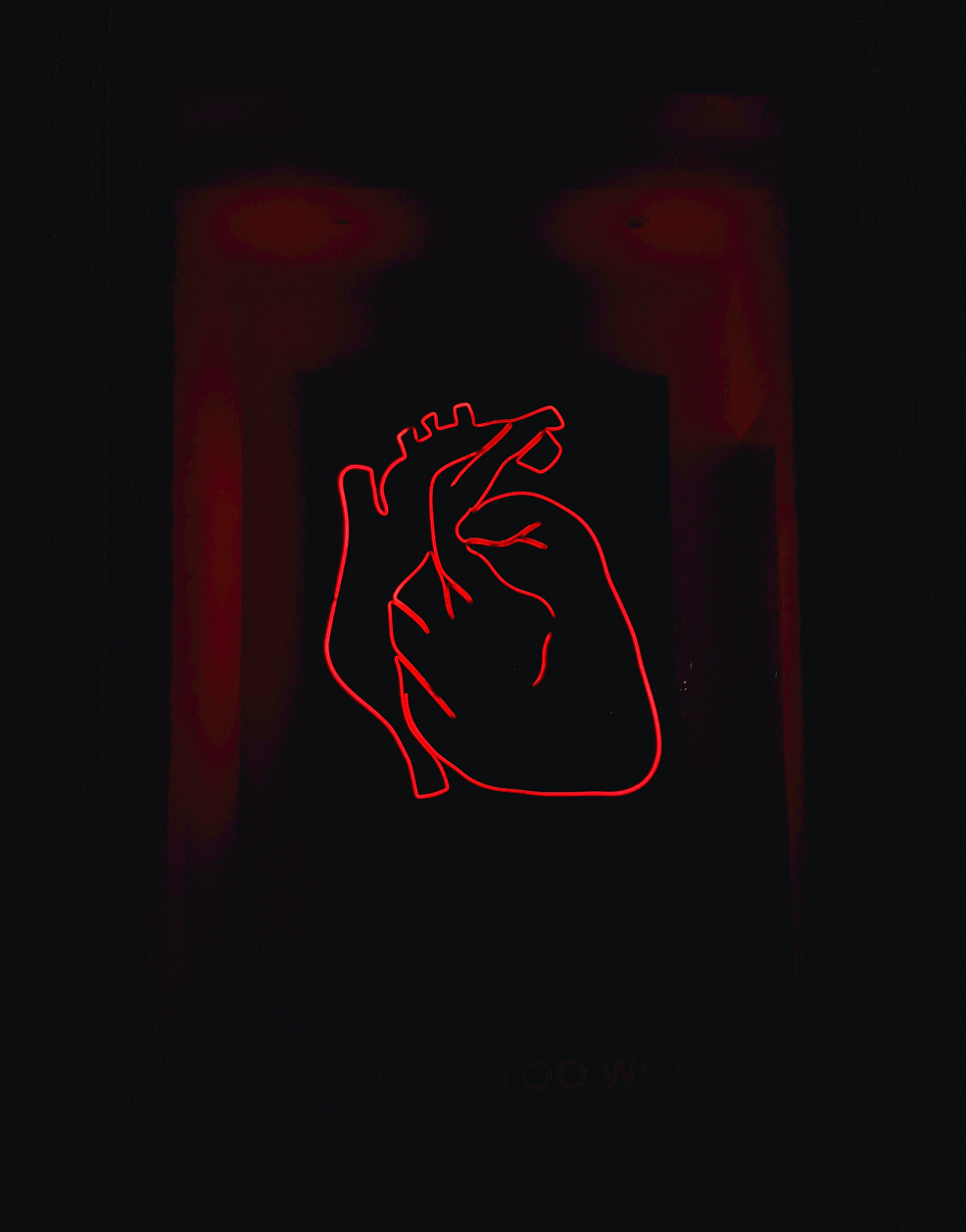 의학 정보 비후성 심근증hypertrophic Cardiomyopathy Hcm 증상과 치료 및 예방