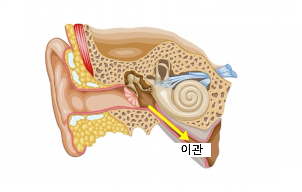 이관개방증 원인과 치료 자연 치유 가능 고유스토리