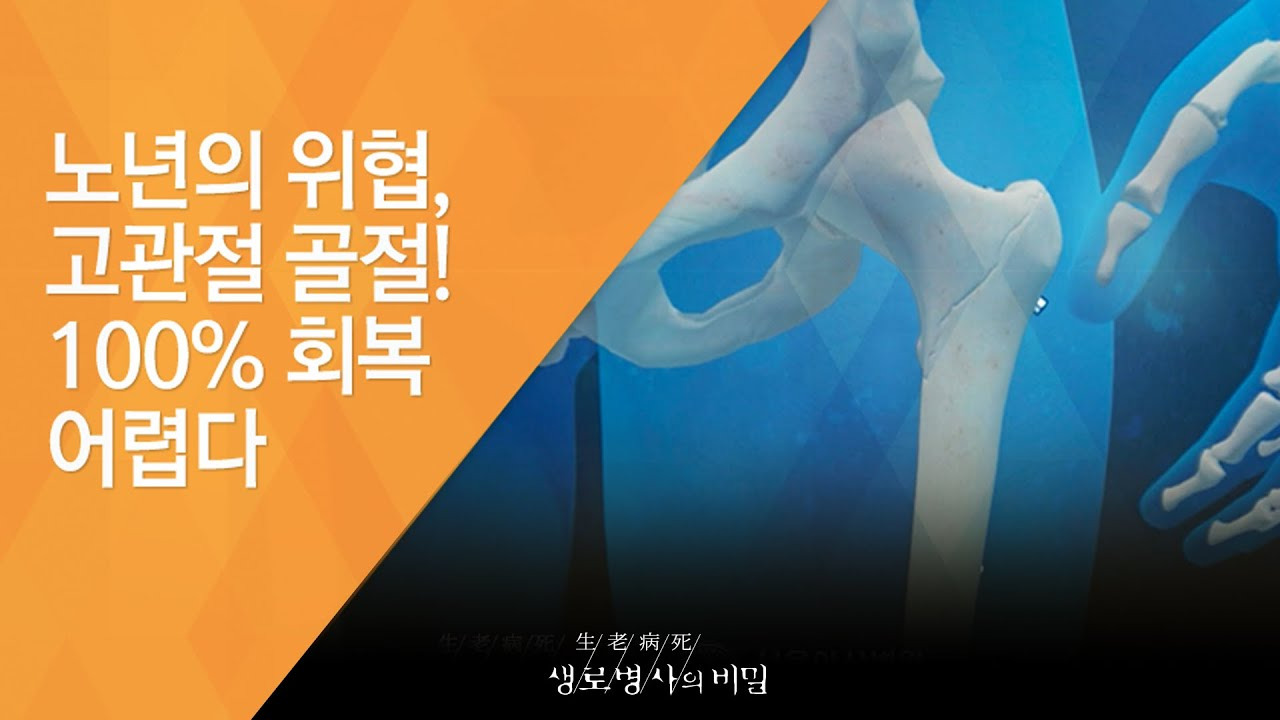 고관절 골절 예방을 위한 관리방법 알아보기