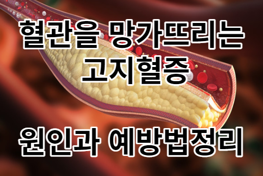 고지혈증 6가지 원인과 예방법 알아보기