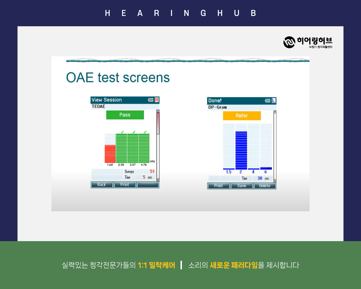 청성뇌간 반응검사 Abr 청각장애 평가 청력평가 종류