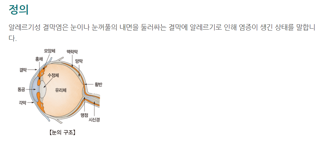알러지 결막염 증상과 치료 정보 건강 쉼표