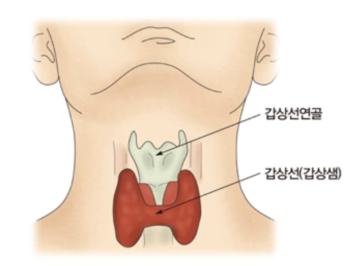 갑상선 기능 저하증과 갑상선 기능 항진증은 무엇일까