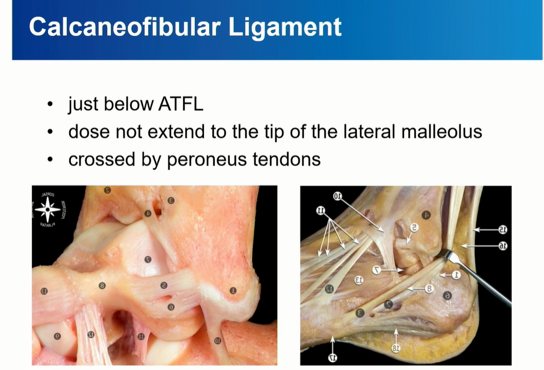 발목 MRI 공부_Ankle ligaments