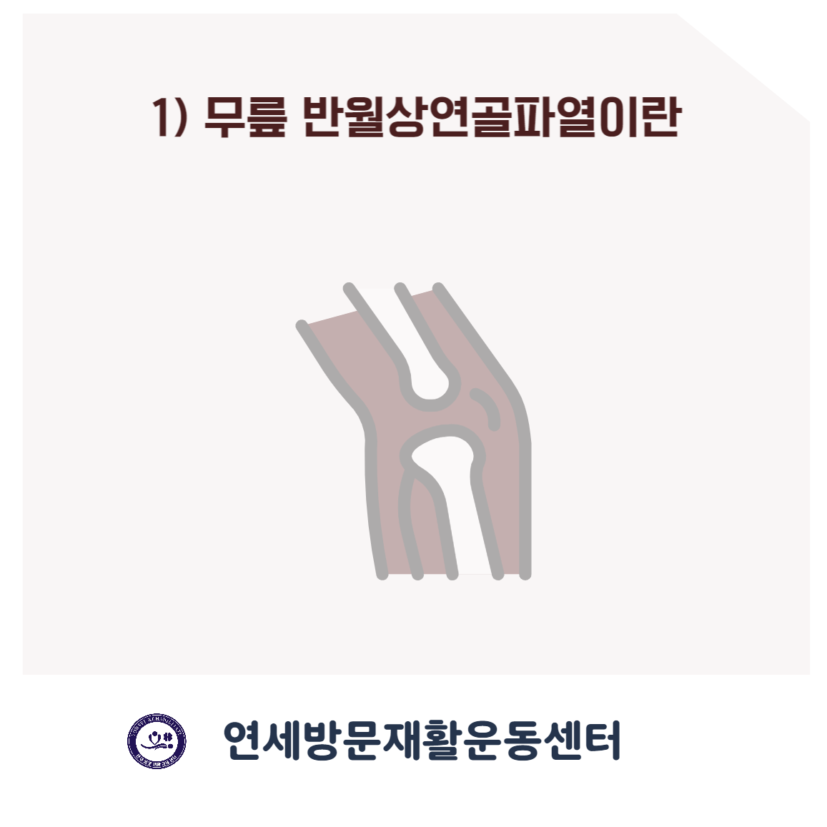 무릎 반월상연골파열 증상 회복기간 비수술치료 수술후 재활 치료 운동 관리 방법