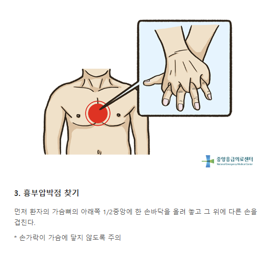 심폐소생술cpr 가슴압박 분당 횟수