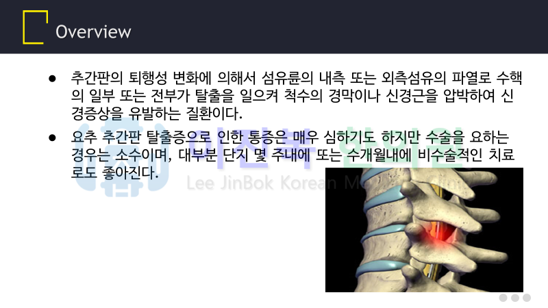 전주 이진복한의원 요추 추간판탈출증허리 디스크