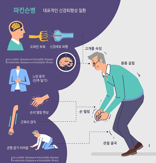 파킨슨병 원인