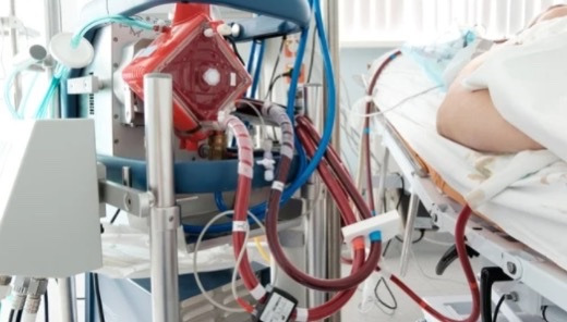 에크모ecmo 적응증 금기 구조 유형 카테터