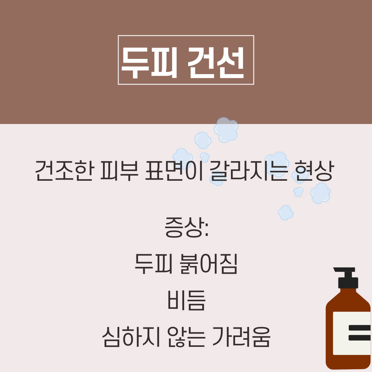 머리가 가려운 이유 머리 가려움 증상 해결 방법