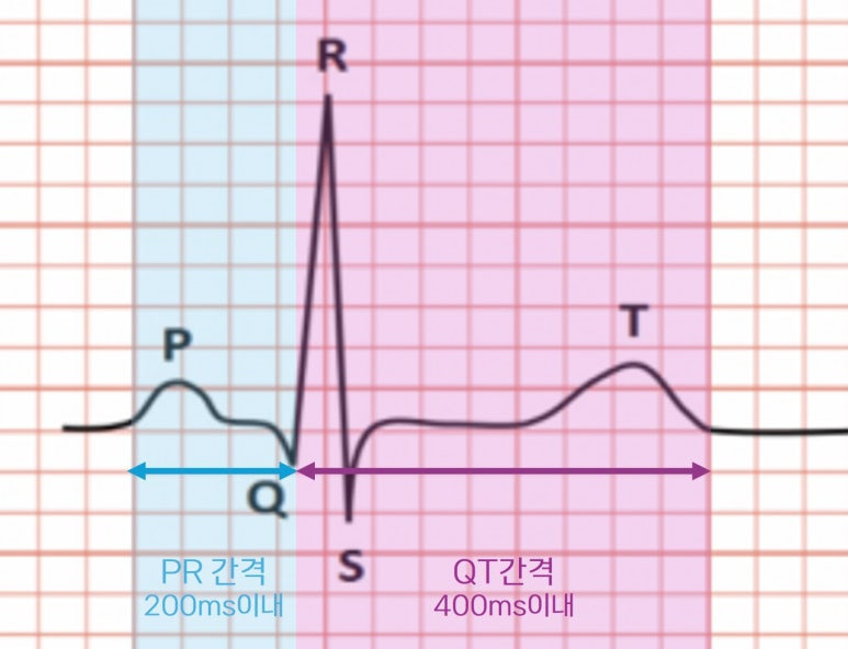 Ecg 기초정리 1 심전도 기초설명 심전도의 원리 사지유도 정상심전도