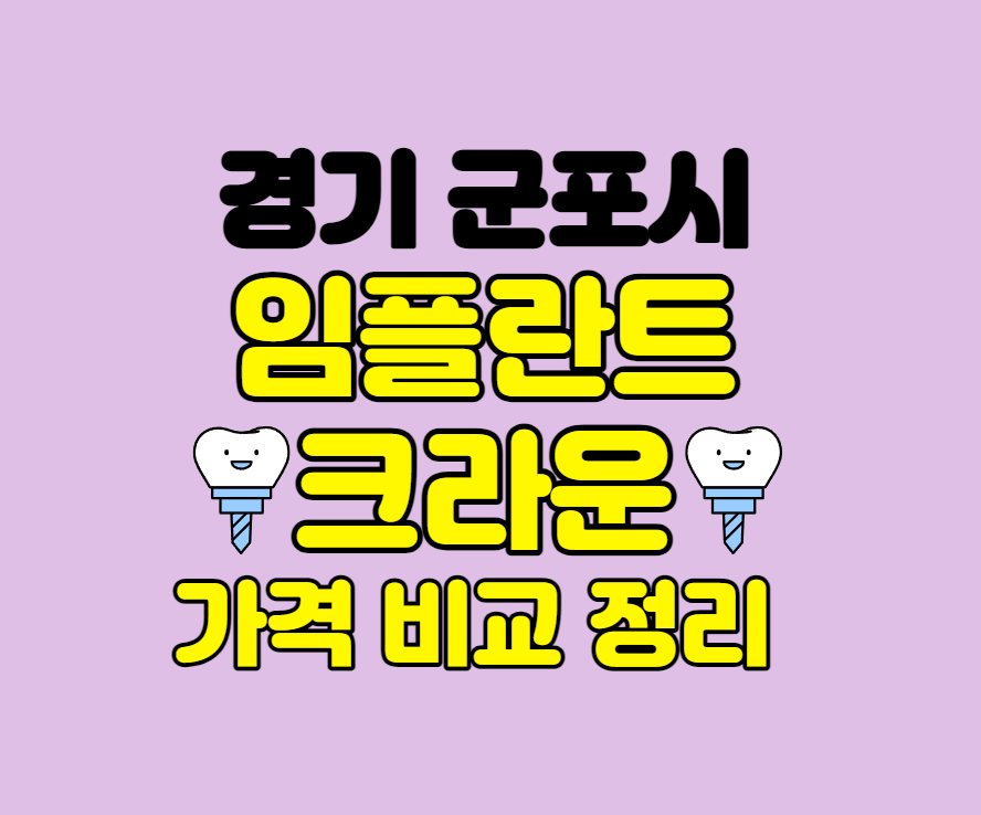 경기 군포시 임플란트크라운 잘하는 곳 저렴한 곳 치과 Top 10