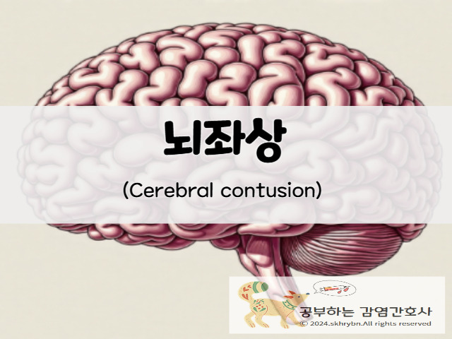성인간호뇌좌상cerebral Contusion 이해하기 원인 증상 치료