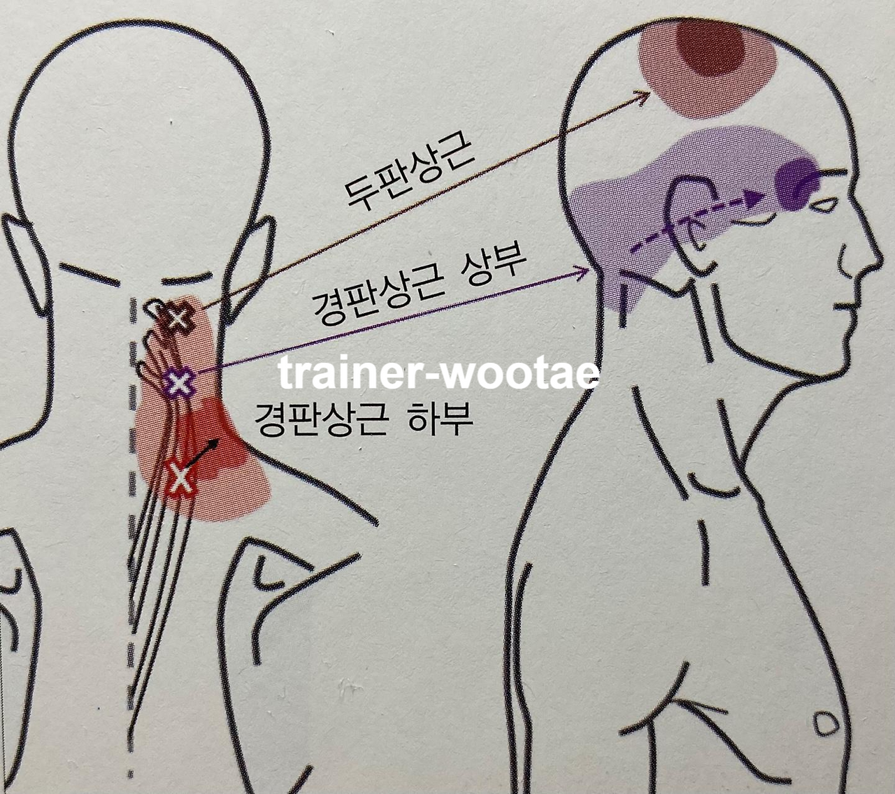 5 판상근splenius 해부학 알면 이득 모르면 손해