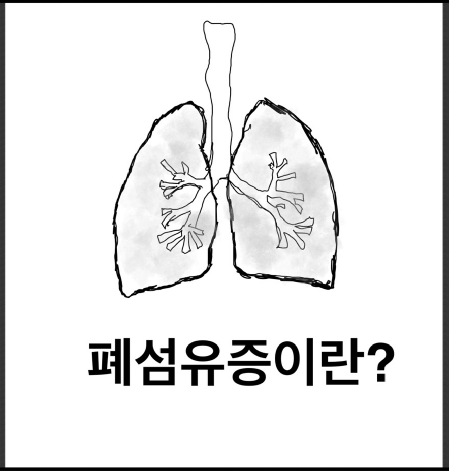 폐섬유증 폐섬유화 증상과 치료법