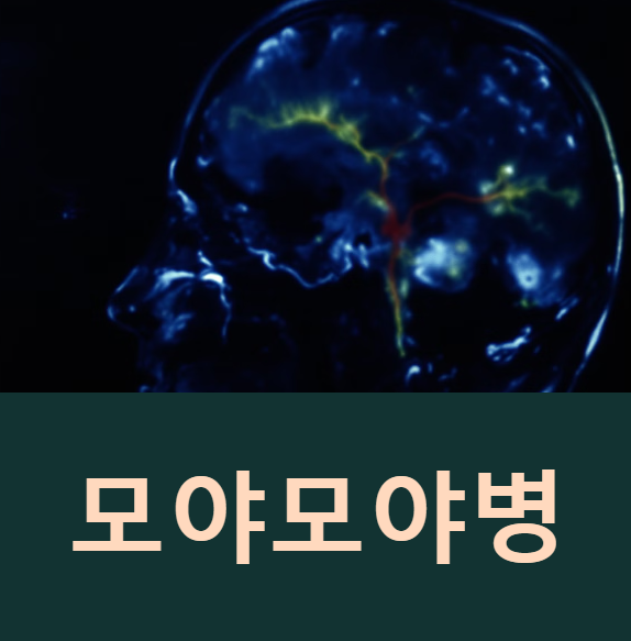 모야모야병 유전 뜻 증상 원인 뇌출혈 수술 치료 진단방법 알아보기 일상 흥미진진