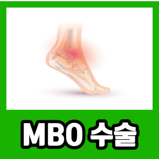 발목인대파열 인대재건술 Mbo 수술준비 수술과정