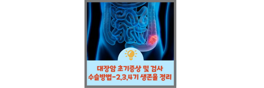 대장암 초기증상 및 검사 수술 방법 2기 3기 4기 생존율 총정리