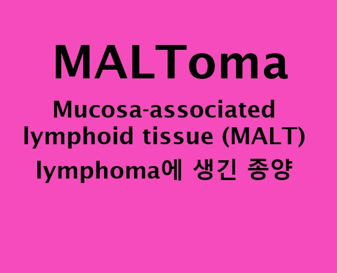 조직검사 결과 MAlToma?