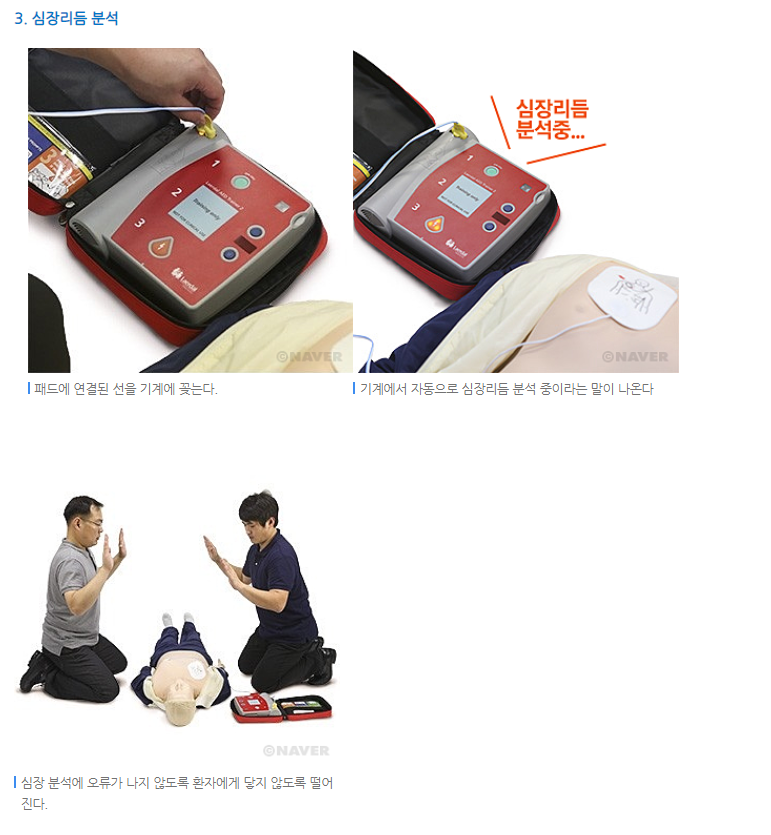 자동 심장충격기 자동제세동기aed 순서 및 작동법