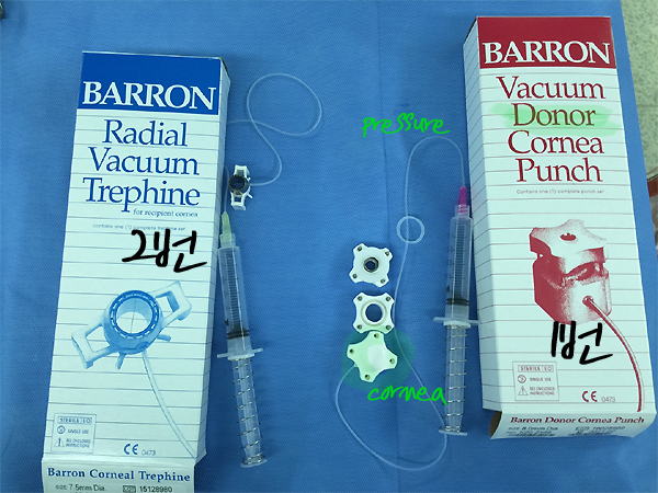PKP 각막이식 Tripple procedure