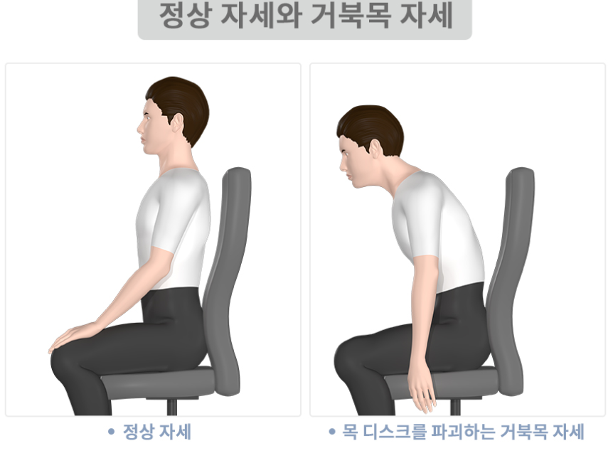 목디스크에 좋은 운동 10가지 정리