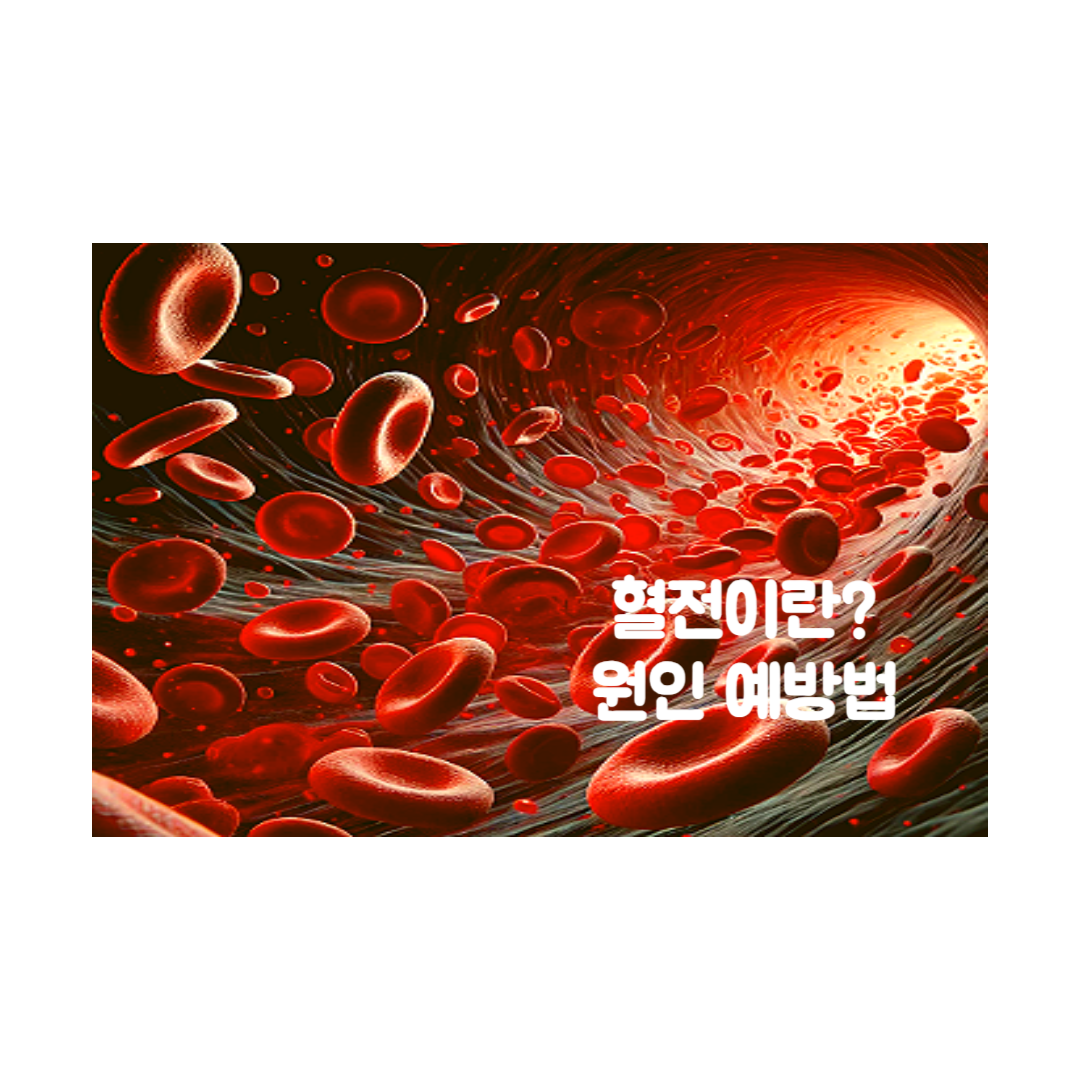 혈전이란 혈전 원인 증상 혈전없애는법