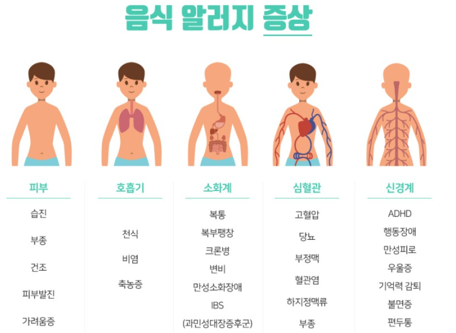 지연성 알레르기 검사와 Mast검사