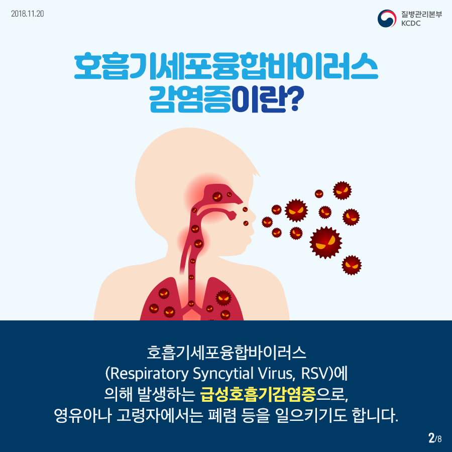 호흡기 세포 융합바이러스rsv 감염증 감기처럼 왔다 폐렴으로