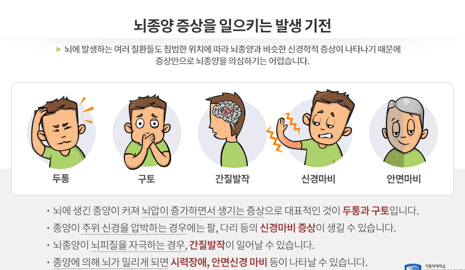 뇌종양 원인 증상 치료방법 명의