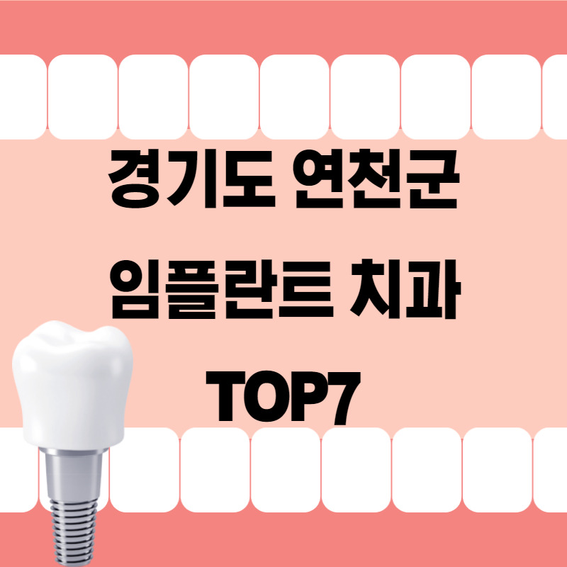 연천군 임플란트 치과 잘하는곳 추천 Top3 가격 저렴한곳 후기 많은곳 유명한곳