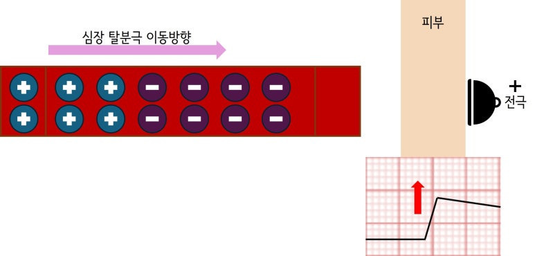 Ecg 기초정리 1 심전도 기초설명 심전도의 원리 사지유도 정상심전도