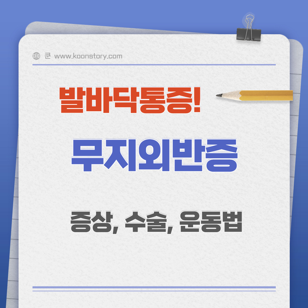 무지외반증 수술 운동법 교정기 증상 발바닥통증 발가락통증 족저근막염