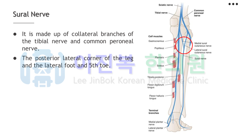 전주 이진복한의원 비복신경 포착증후군