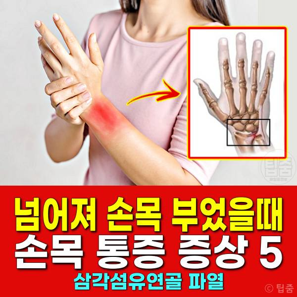 넘어져서 손목이 부었을때 손목통증 삼각섬유연골파열 증상 5가지