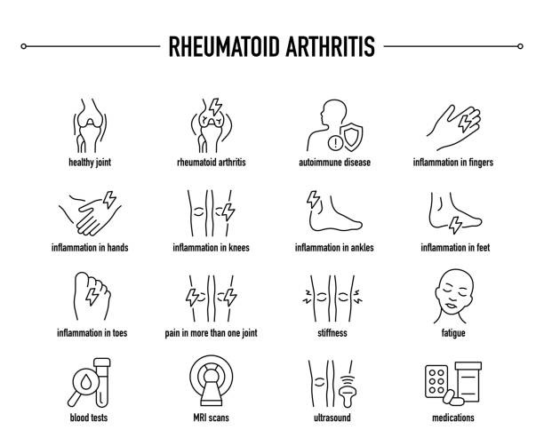 류마티스 관절염rheumatoid Arthritis 원인 증상 및 치료 방법