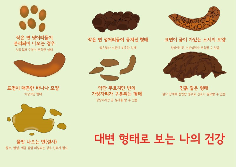 대변 색깔로 살펴보는 건강상태 5가지 녹색초록색 검은색 회색변 흰색변