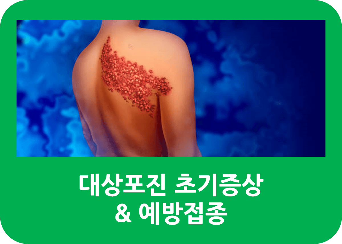 대상포진 유행 원인과 초기증상 진단과 치료방법 합병증 예방접종 시 주의사항 알아보고 건강 지키세요