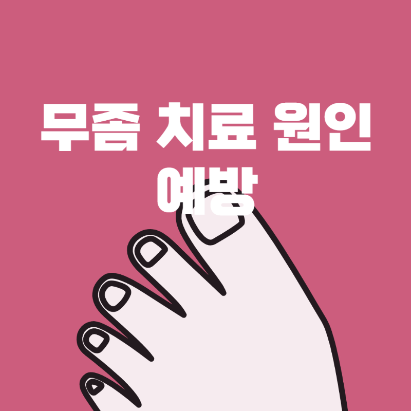 발톱 무좀 치료 원인 발바닥 무좀 예방