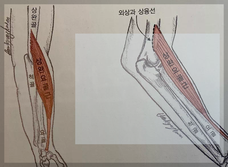 상완요골근 통증의 원인과 치료법