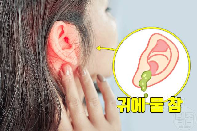 비염 증상 비슷한 암 비인두암 증상 6가지 한쪽코막힘 목에혹이만져져요 귀가먹먹하고아픔