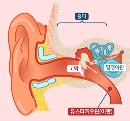 소리를 듣고 균형을 유지하는 중요한 기관 '귀 질환'