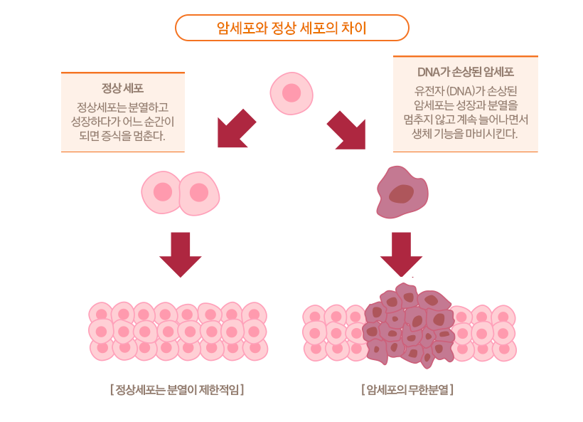 한국인 사망원인 1위 ‘암 그 원인과 치료법은