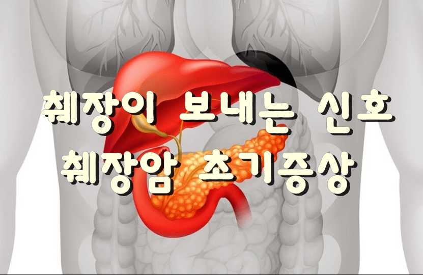 췌장암 초기 증상 10가지 알아보기 진단방법 생존율 예방법 좋은음식