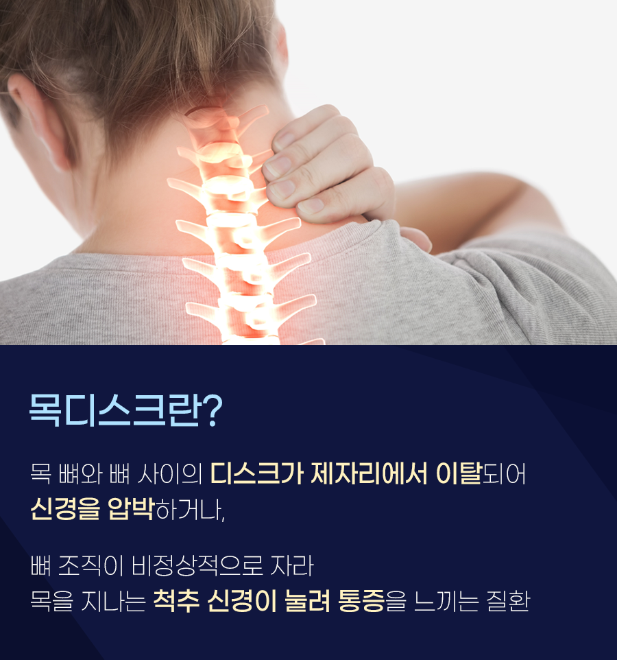 목디스크 증상 보인다면
