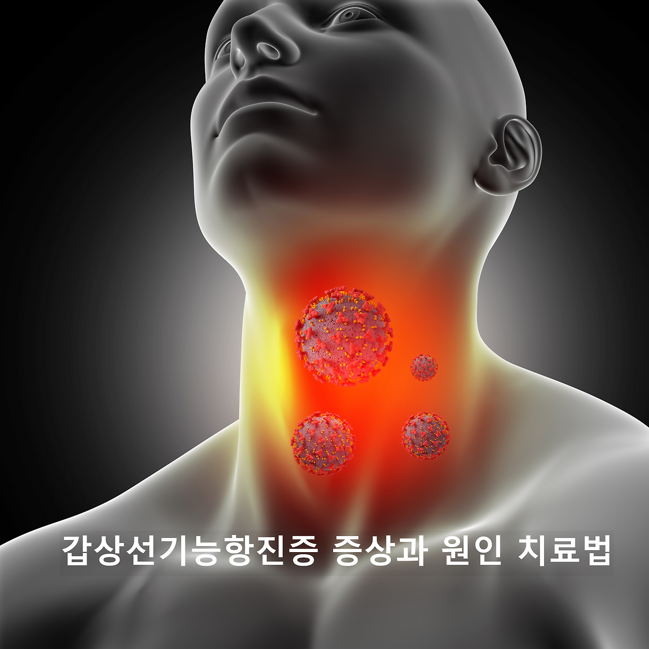 갑상선기능항진증 증상과 원인 및 치료 방법