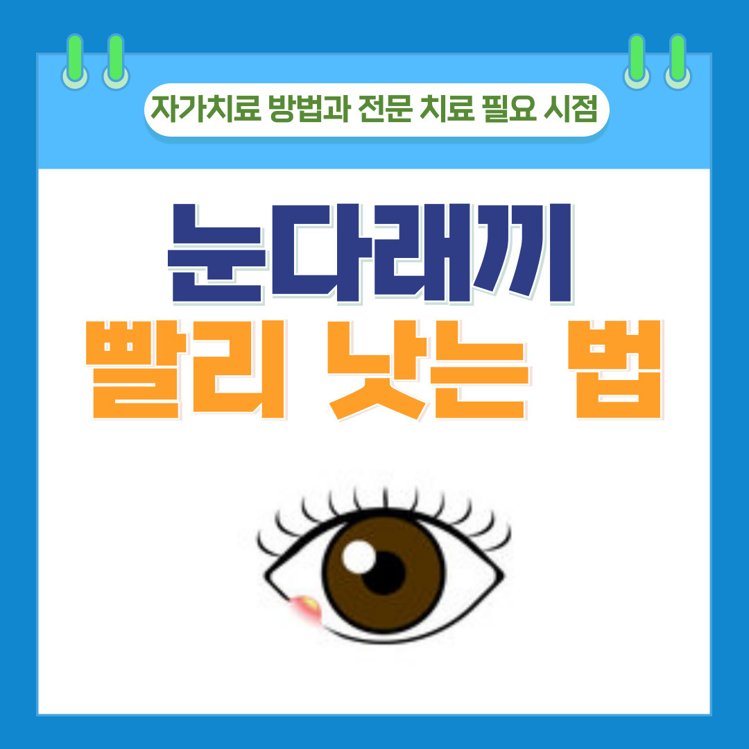다래끼 빨리 낫는 법 5가지 효과적인 자가치료 방법과 전문 치료 필요 시점