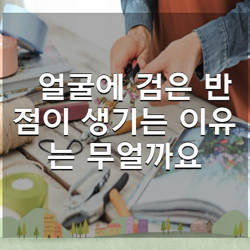 얼굴에 검은 반점이 생기는 이유는 무얼까요