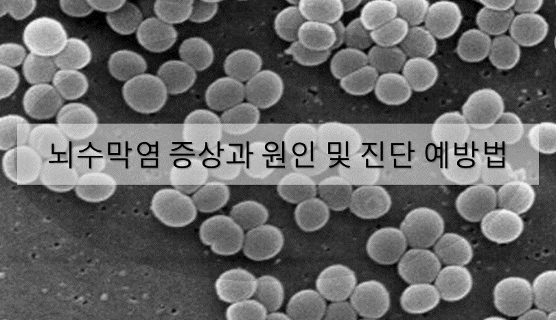 뇌수막염 증상과 원인 및 진단 예방법