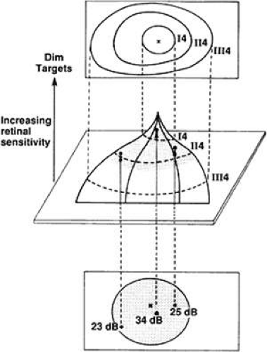 시야검사, Visaul field test의 개념, 시야의섬, Traquair Island of Vision